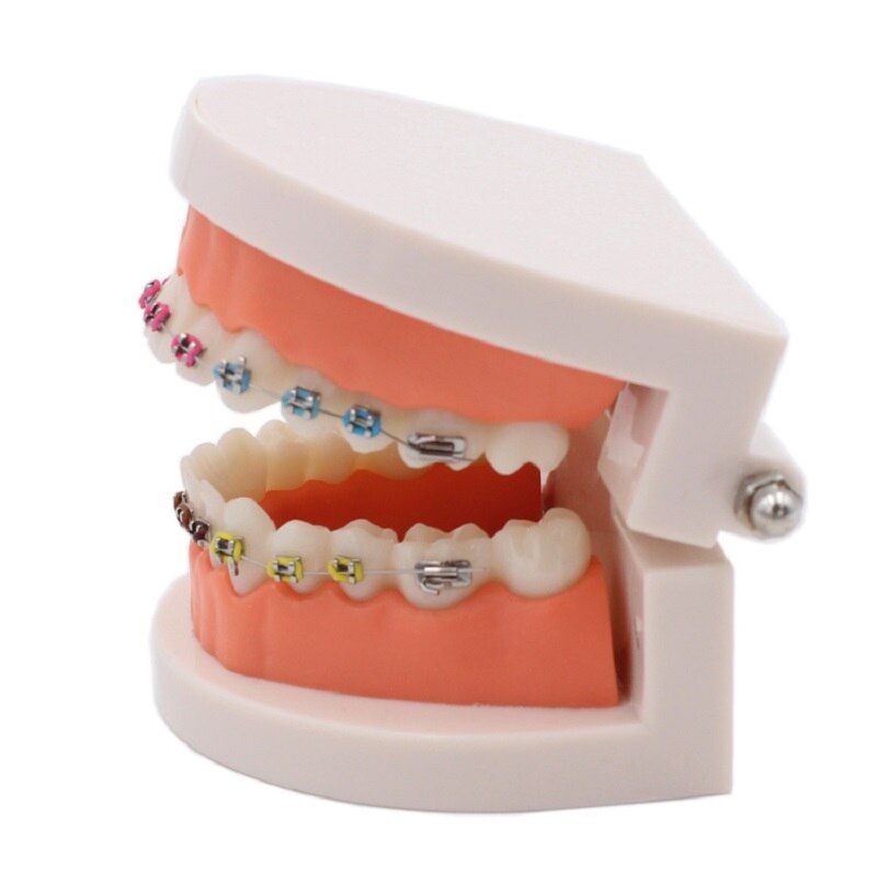 Arcada dental brackets modelo de tratamiento de ortodoncia dental